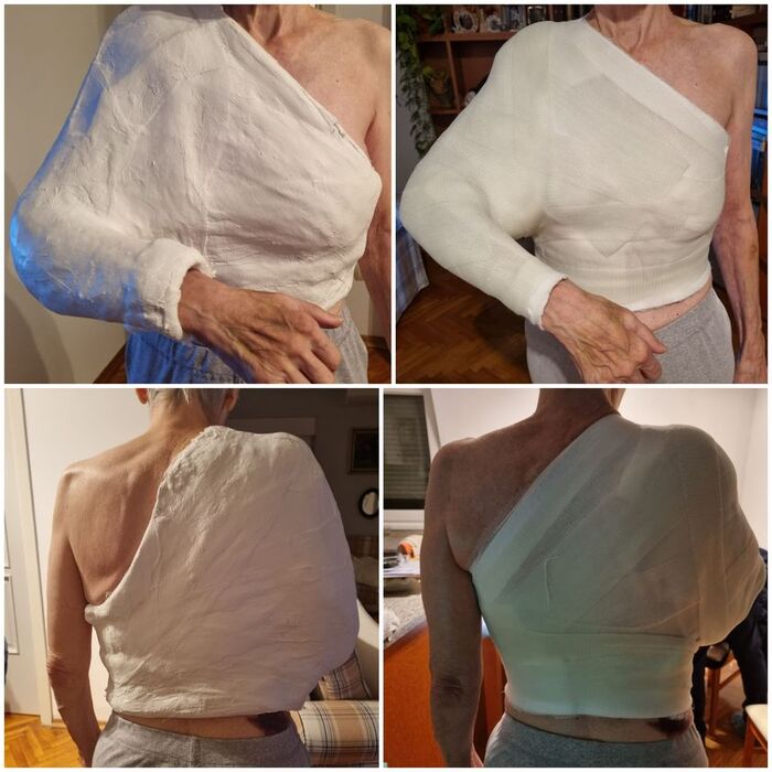 Plastični gips :: plastični.gips