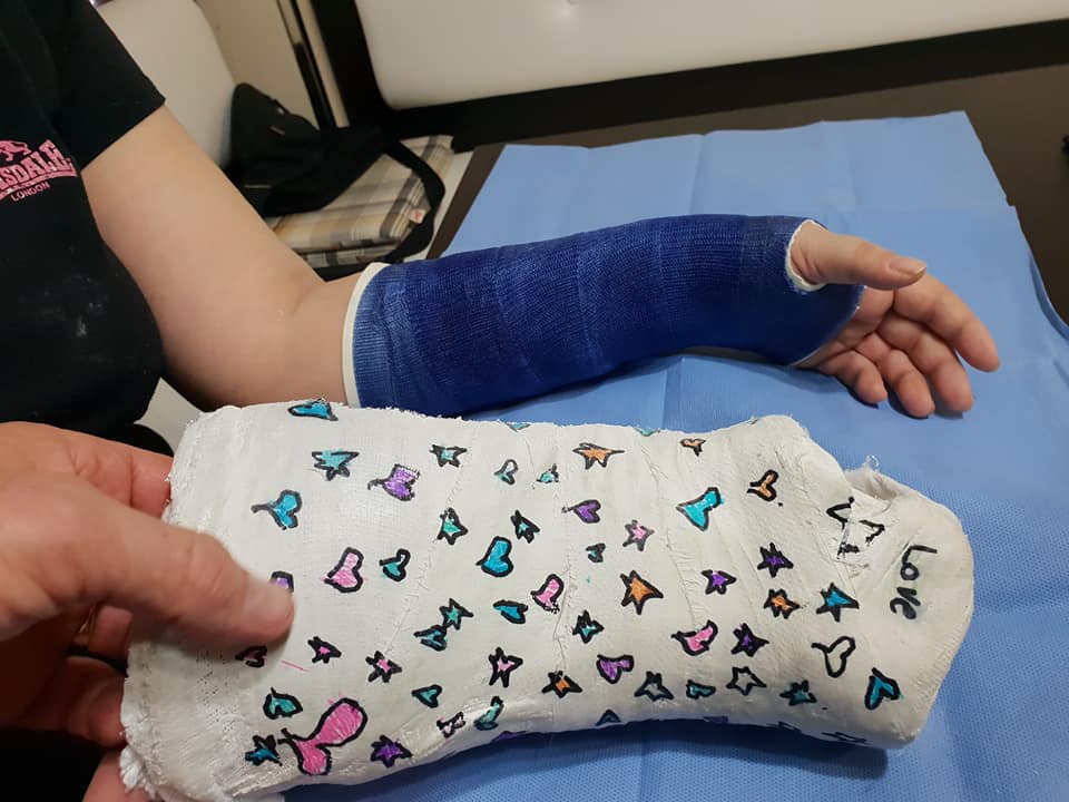 Plastični gips :: plastični.gips