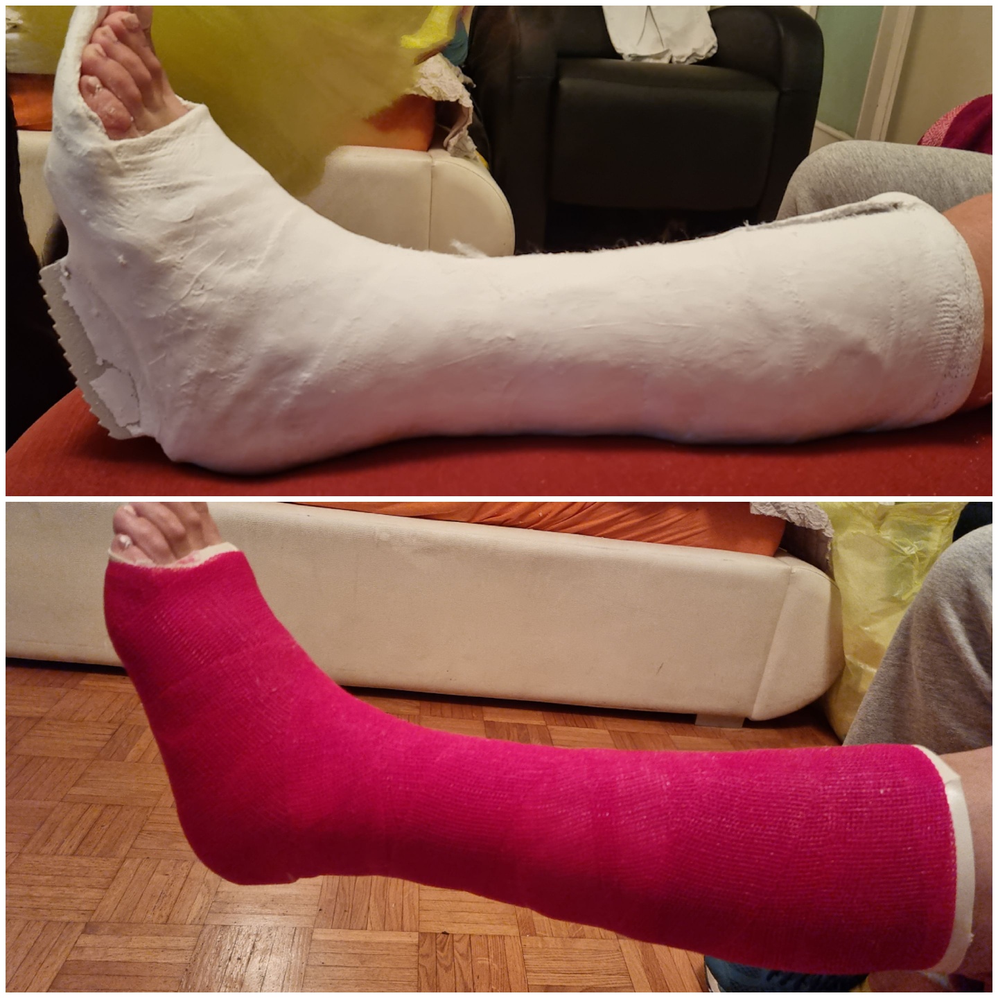 Plastični gips :: plastični.gips