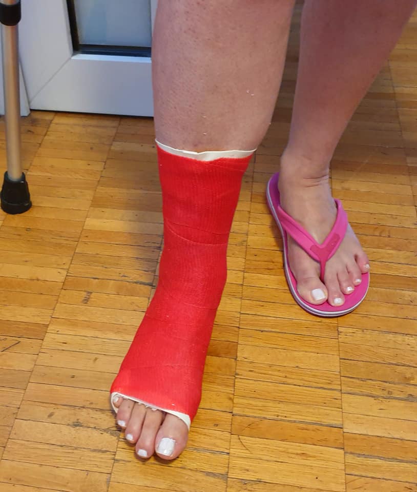 Plastični gips :: plastični.gips