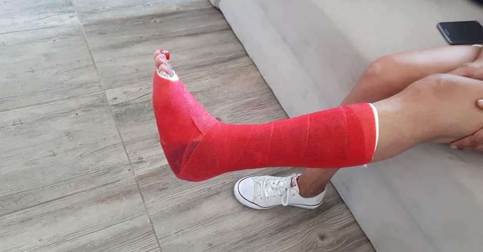 Plastični gips :: plastični.gips