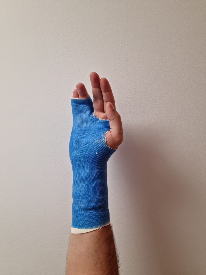 Plastični gips :: plastični.gips