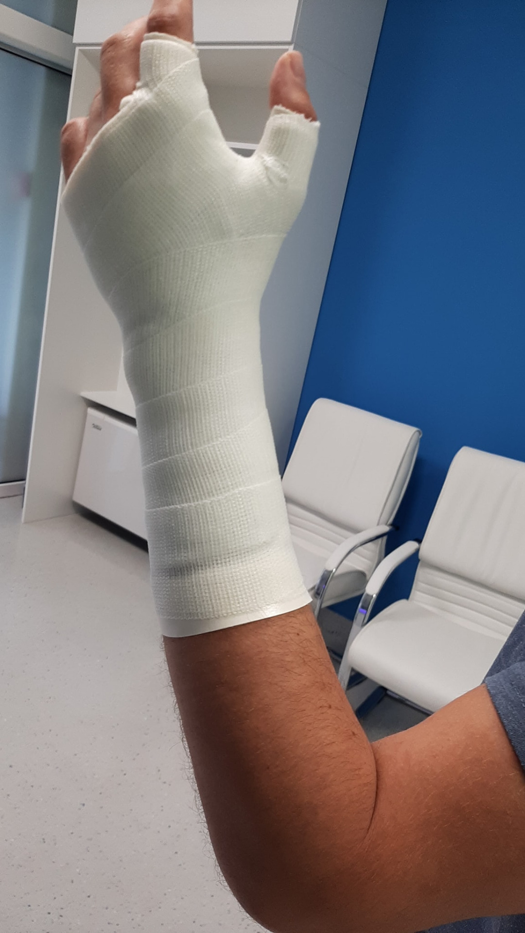Plastični gips :: plastični.gips