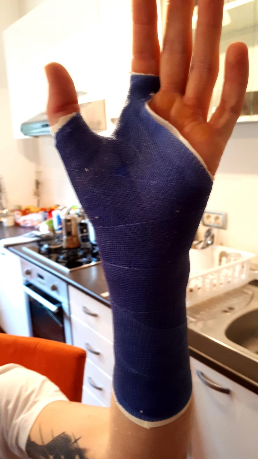 Plastični gips :: plastični.gips