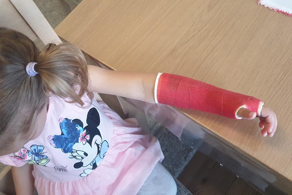 Plastični gips :: plastični.gips