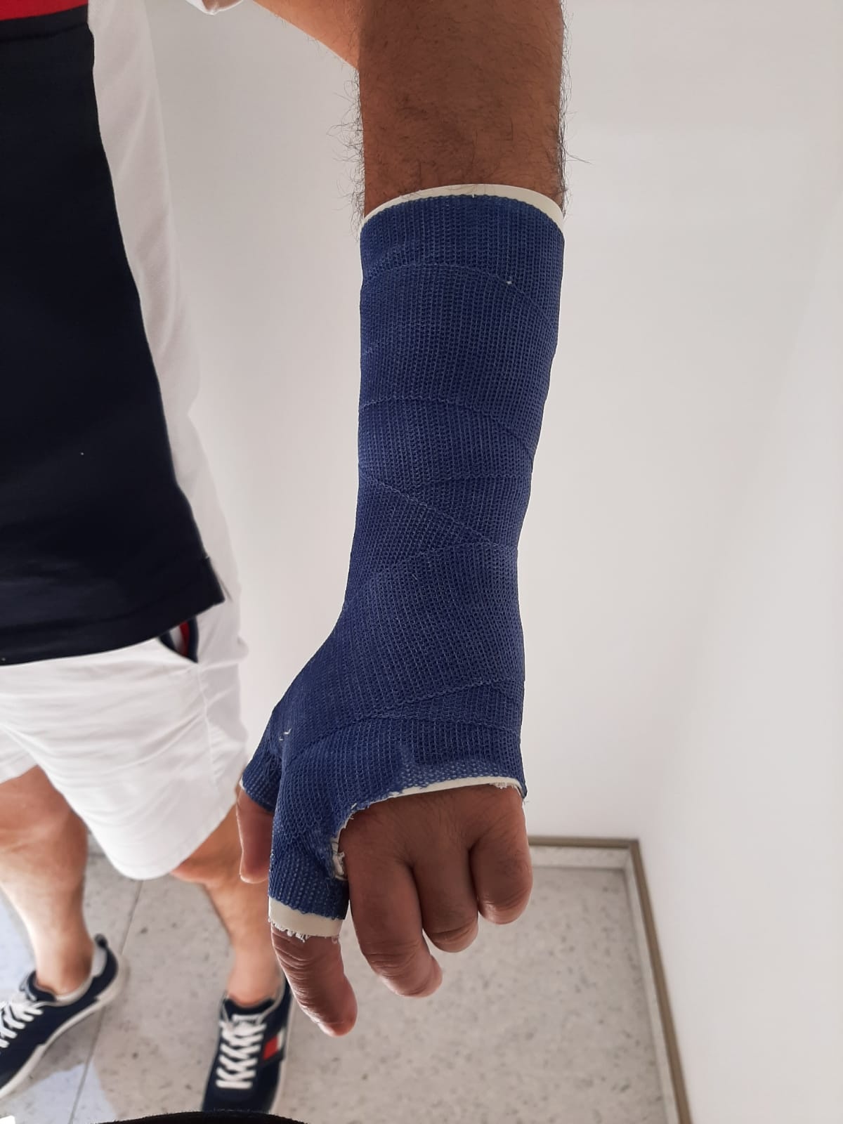 Plastični gips :: plastični.gips