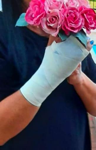 Plastični gips :: plastični.gips