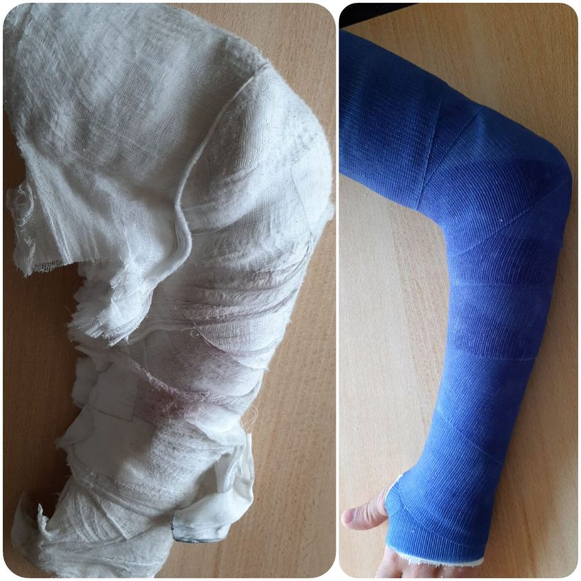 Plastični gips :: plastični.gips