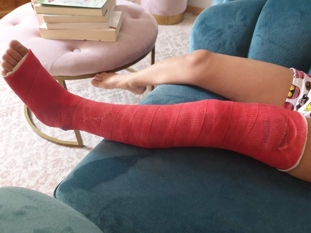Plastični gips :: plastični.gips