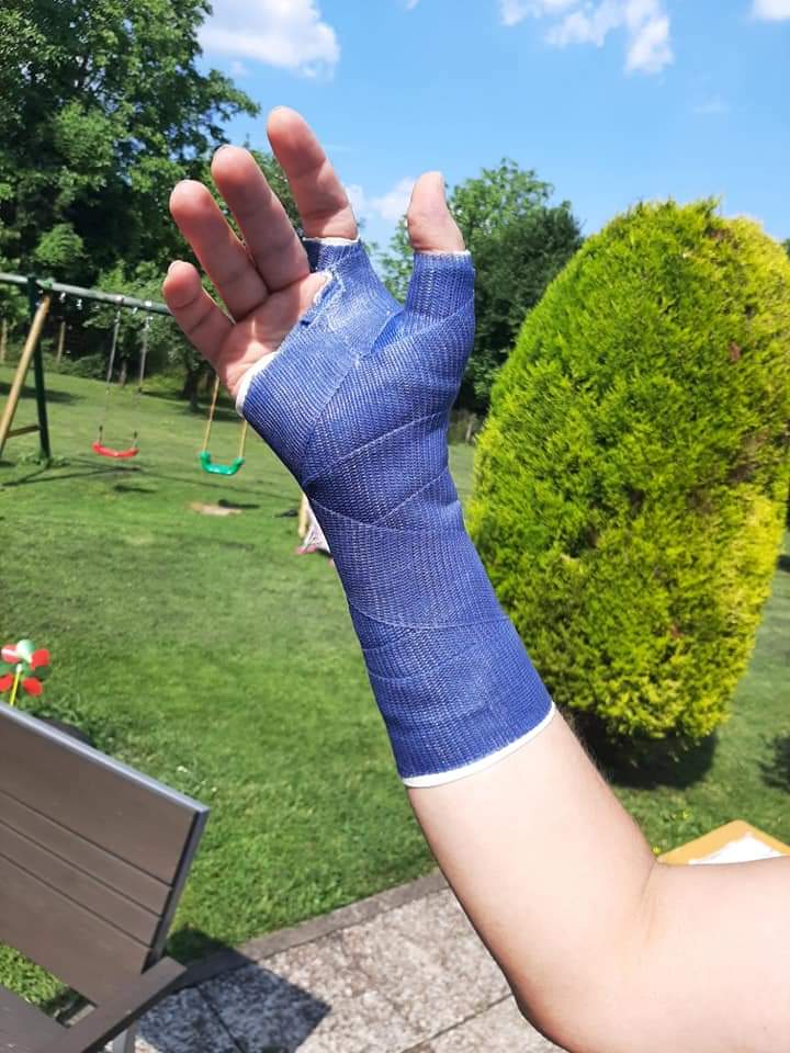 Plastični gips :: plastični.gips