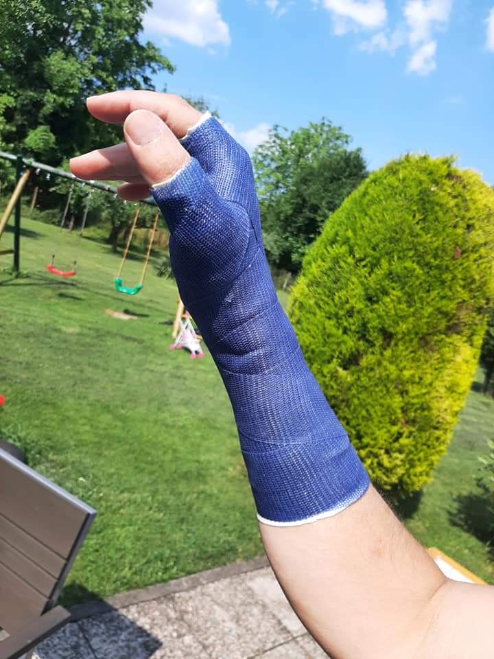 Plastični gips :: plastični.gips